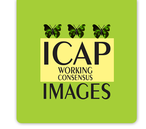 IWAA 2014 | 12th International Workshop on Autoimmunity and Autoantibodies